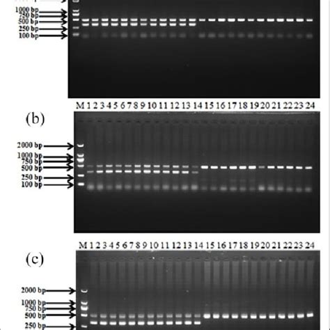 Sex Identification By Dissection And Pcr Amplification A Verifying