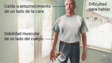 Un Ataque De Acv Mata 2 Millones De Neuronas Por Minuto Infobae