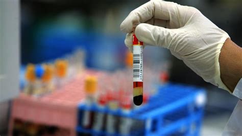 What Does The TSH 3rd Generation Test Mean