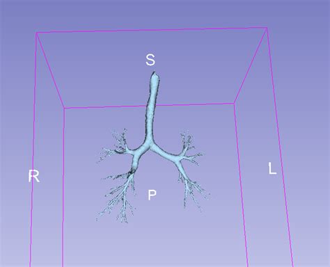 Lung Segmentation Problem With The Level Of Details Slicercip 3d Slicer Community