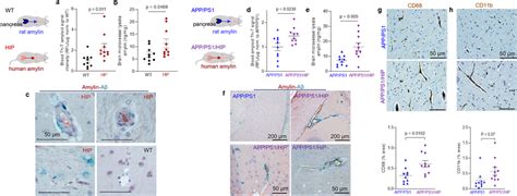 Cerebrovascular Amylin Aβ Deposition Induced By Amyloid Forming Human Download Scientific