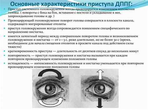 Доброкачественное пароксизмальное позиционное головокружение презентация онлайн
