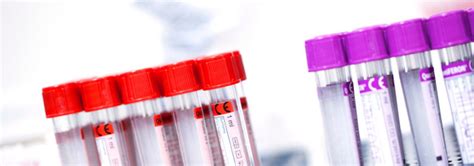 Quantiferon® Tb Gold Plus Ssi Diagnostica