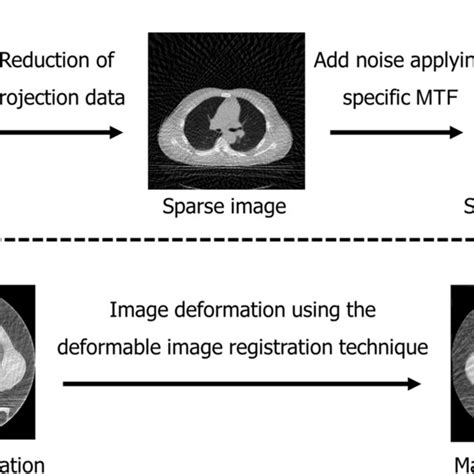 Dose Distributions In A Volumetric Modulation Arc Therapy Vmat Plan Download Scientific