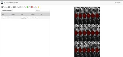 `sctqc P Sctdeepseglesion` Supports Only Binary Lesion Masks