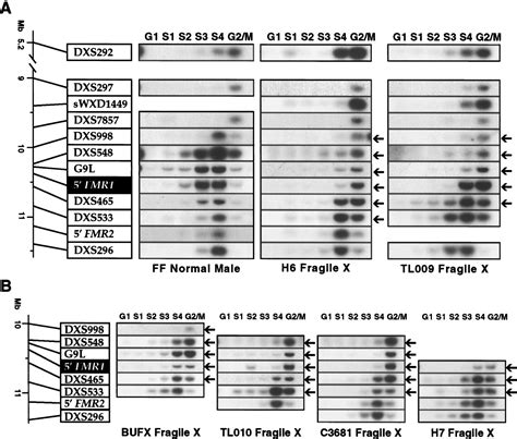 Figure 2 From A Variable Domain Of Delayed Replication In Fraxa Fragile X Chromosomes X