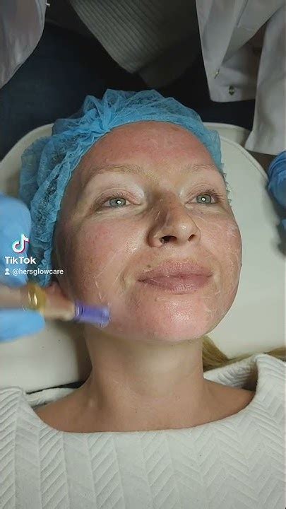 جلسة ديرما بن Youtube