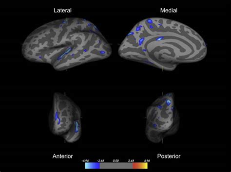 Visual Cortex Fmri