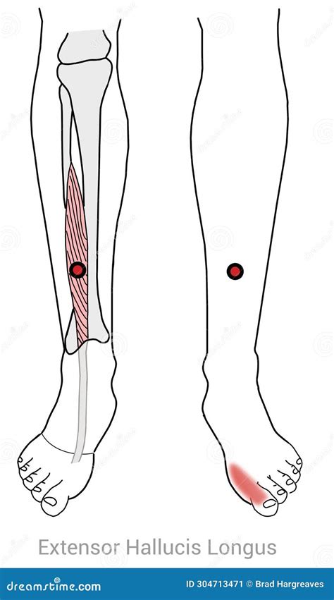 Extensor Hallucis Longus Stock Illustration Illustration Of Muscular 304713471