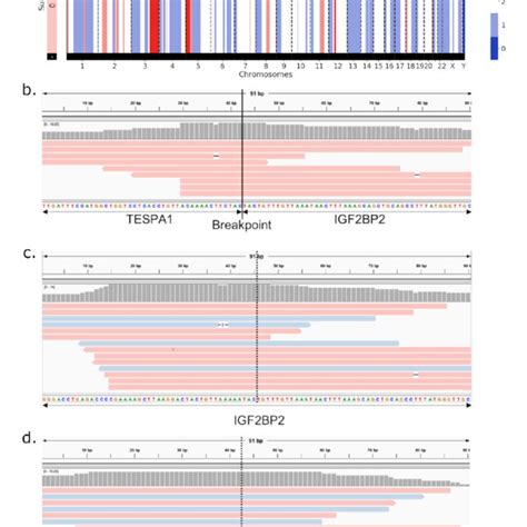 Igf2bp2tespa1 Fusion Breakpoint Validation In Scdna A Copy Number