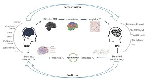 Brain Network Models Show Promise In Personalized Medicine