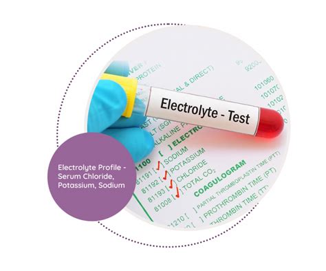 Electrolyte Profile MediScan Lab