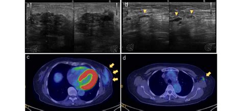 Clinical Imaging Findings At Initial Examination A Ultrasound Of The Download Scientific