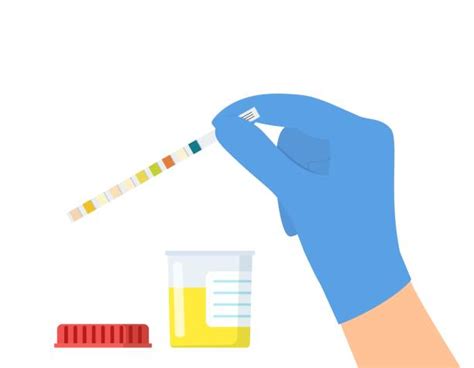 Urine Sample Container Illustrations Royalty Free Vector Graphics