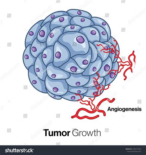 Tumor Growth Illustration Angiogenesis Stock Vector Royalty Free 1996277942 Shutterstock