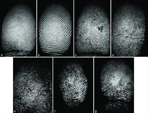 The Various Finger Ridge Patterns Showing Plain Arch A Tented Arch Download Scientific