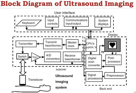 Ultrasound Machine Diagram