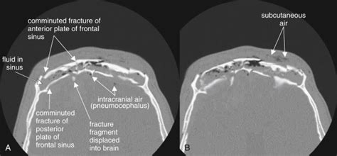 Imaging The Face Radiology Key
