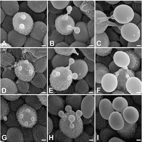 科学网—美丽的真菌世界——担子和担孢子 刘伟的博文