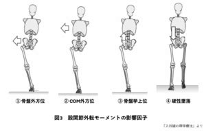 股関節外転モーメントと外転筋群の痛みや張り感について 理学療法士園部俊晴のブログ