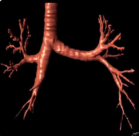 Bronchi Definition Location Anatomy Functions Pictures
