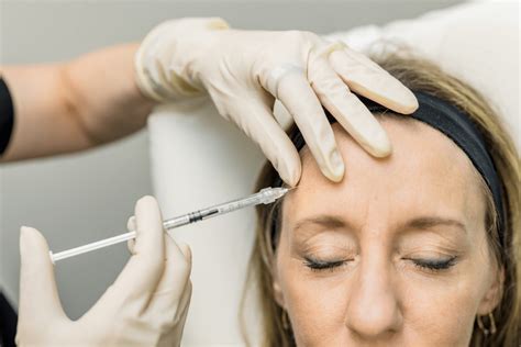 Botox Longevity Unlocking The Mystery Be Beautiful Medical