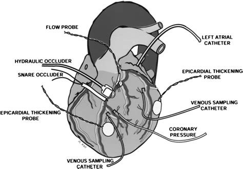 Surgical Instrumentation Of Heart Download Scientific Diagram