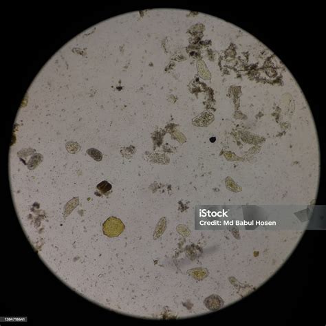 Vegetable Cell Of Stool Analysis Under Microscope Fecul Vegetable Cell