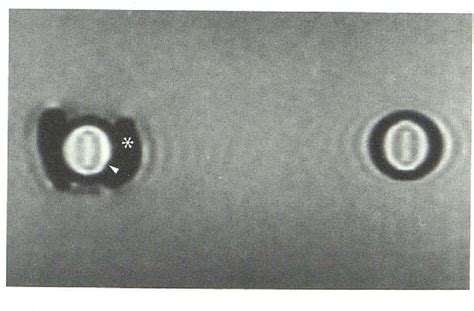 Figure 1 From Gradient Recalled Echo Mr Imaging Magnetic