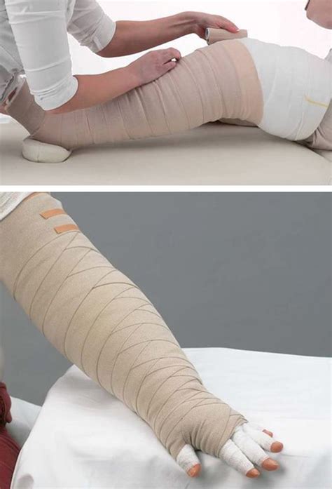 Treatment For Lymphedema The Lymphedema Association Of Manitoba Lam