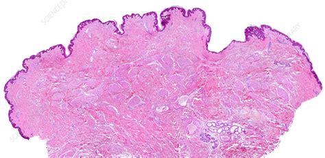 Human Nipple Light Micrograph Stock Image C056 7672 Science Photo Library