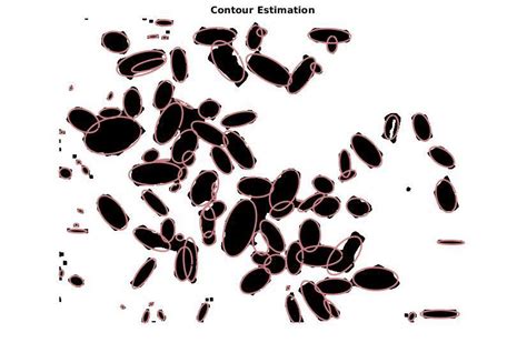 Final Segmentation Result Of Our Proposed Algorithm On Sample Image