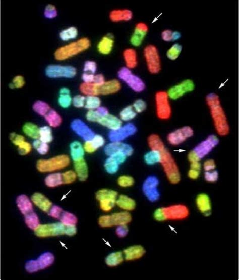 Figure 1 From The Sky Cgh Database For Spectral Karyotyping And Comparative Genomic