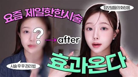 지금 우리나라에서 가장 핫한 얼굴형 시술 받고옴 탑 모델들이 쓴다는 화장품 시술 후 관리 법 알려드림 Youtube