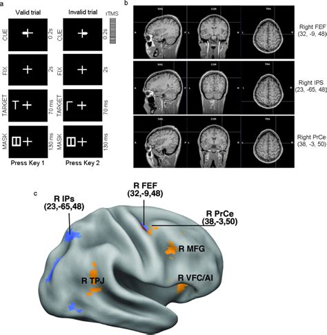 Frontoparietal Cortex Controls Spatial Attention Through Modulation Of Anticipatory Alpha