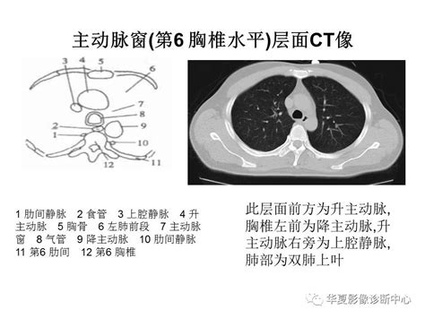 胸部ct基本读片知识概述 医学界 助力医生临床决策和职业成长