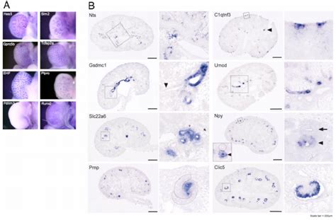 In Situ Hybridization Validation Of Microarray Results Download