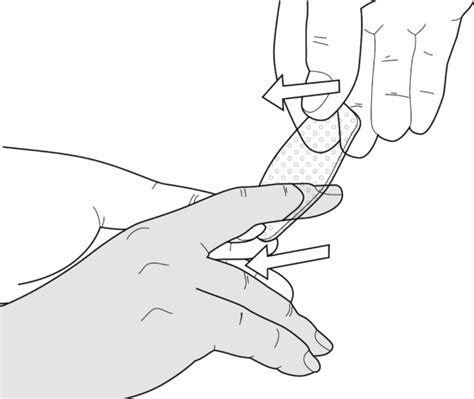 Guide Pip Extension Splints