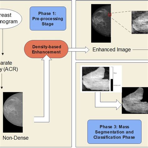 Overall Proposed Methodology For Breast Mammogram Mass Classification
