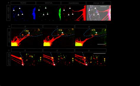 Transfer Of Ror2 Via Producing Cell Cytonemes To Receiving Cells In