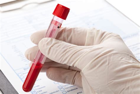 STD Blood Test Results Explained Same Day STD Testing In CLIA