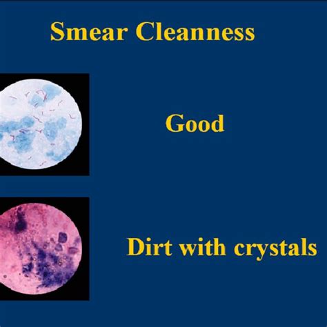 Pdf Afb Smear Micrscopy Manual