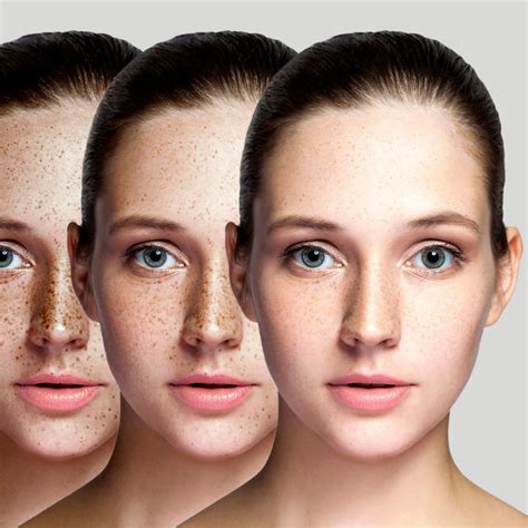 Learn The Foundations Of Pigmentation With The Introduction To Pigmentation Course Advanced