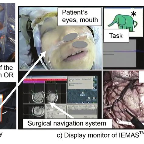 Effect Of Intraoperative Brain Mapping During Awake Craniotomy On Download Scientific Diagram