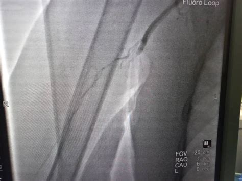 Dr Ahmed Suliman Mbbs Facp Frcp Lon Fesc Facc On Linkedin 70 F