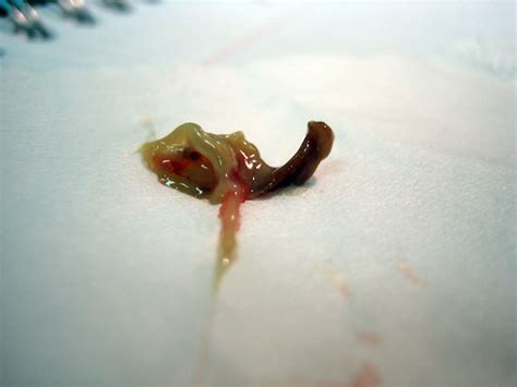 Pulled This Out Of My Nose Feelsgoodman Album On Imgur