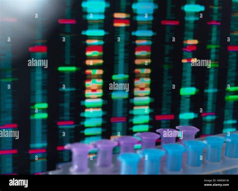 dna research dna test results on a computer screen in the laboratory with a tray of samples in