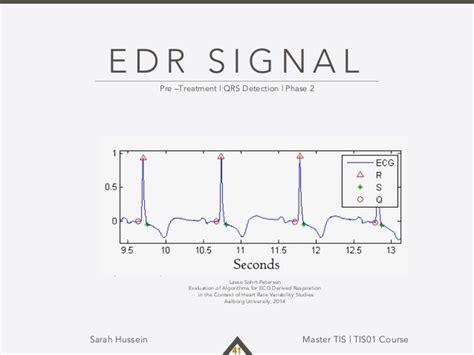 Electrocardiogramm Derived Respiratory Signal Edr Signal