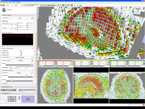 Slicer3dtmri Slicer Wiki