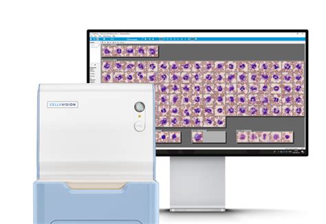 Lab Insights Cellavision